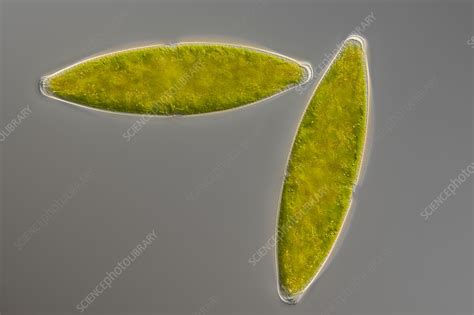 Tetmemorus Granulatus Algae Light Micrograph Stock Image C057 7829 Science Photo Library