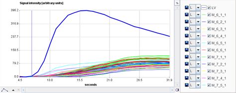 Cardiac Perfusion Data Processing Perfusion Calculation