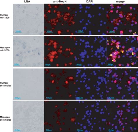 In Situ Staining Of Mir 320b In Prefrontal Cortex First Row Human Download Scientific Diagram