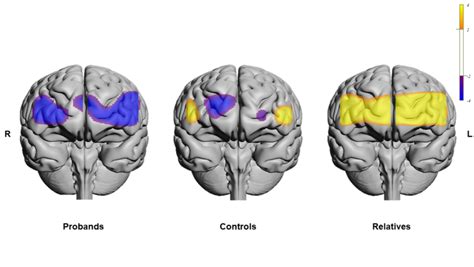 Patterns Of Prefrontal Cortex Activation During Response Inhibition On Download Scientific