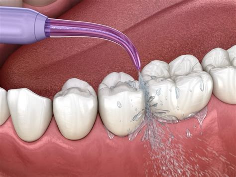 Alternative Options For Flossing Dental Tape Interproximal Brushes