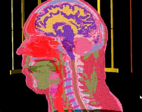 Xfdtd Remcom 中的电磁仿真网格划分