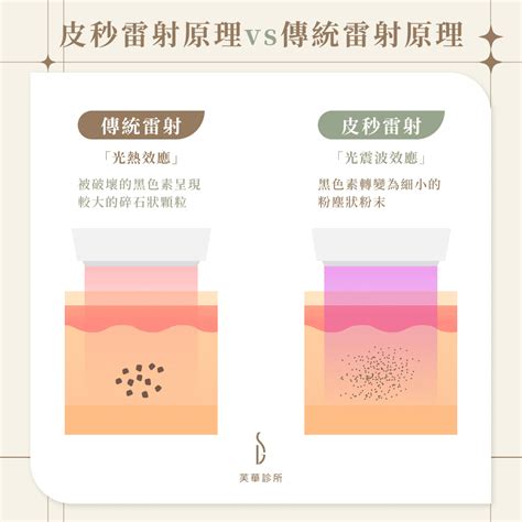 皮秒百科大全｜由功效到價格帶你認識皮秒是什麼