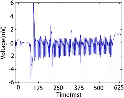 Response Of The Rat Under Electrical Stimulation Response Ecog Signal Download Scientific