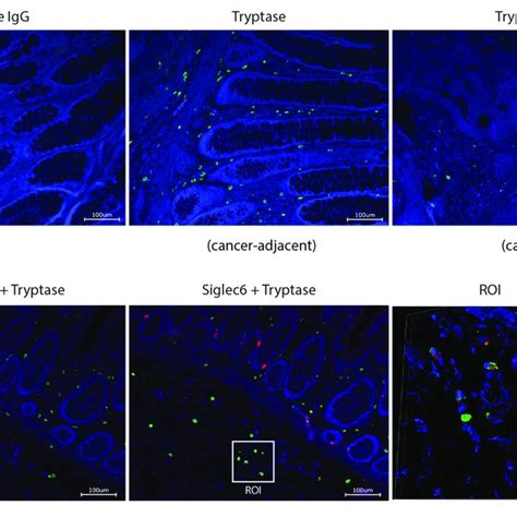 Ligands For Siglec 6 In Human Crc Tissues Lectin Download Scientific Diagram