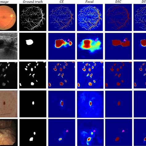 example segmentation with softmax predictions visualised as a heatmap