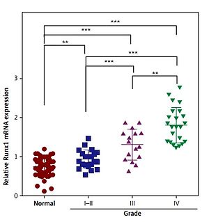 Runx1 Promotes The Development Of Glioma Cells By Regulating JAK STAT Signalling Pathway