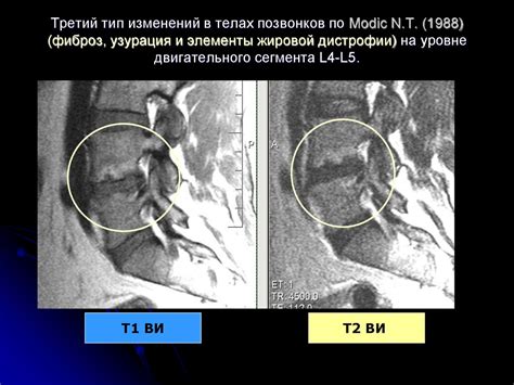 Синдром боли в нижней части спины Лекция 6 презентация онлайн