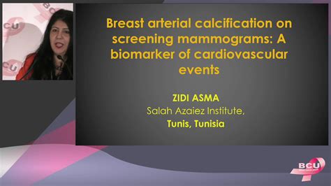 Breast Arterial Calcifications On Screening Mammograms A Biomarker Of
