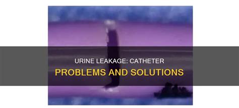 Urine Leakage Catheter Problems And Solutions Medshun