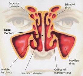 Boggy Edematous Nasal Turbinates
