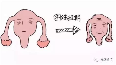 围绝经期综合征围绝经期月经紊乱 随意云