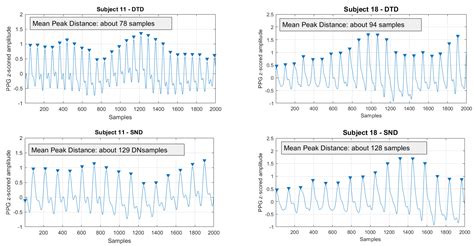Signal Processing Normalization At Heidi Burkholder Blog