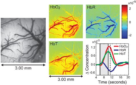 Figure 2 From Ultra Fast Multispectral Optical Imaging Of Cortical