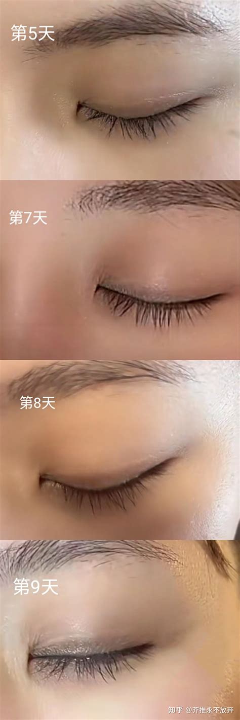 睫毛滋养液打卡芭集使用第9天能看出变长嘛 知乎