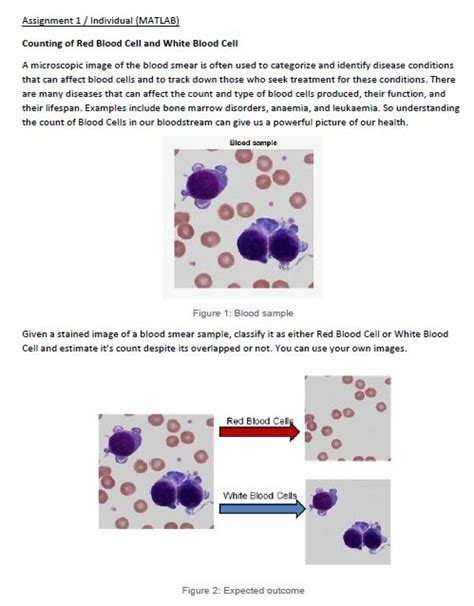 Solved Assignment 1 Individual Matlab Counting Of Red