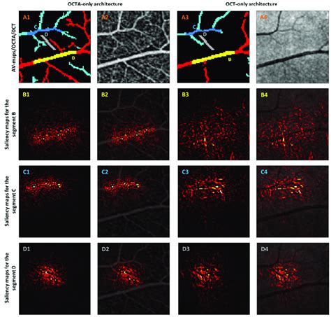 comparative illustration of saliency maps for av segmentation of download scientific diagram
