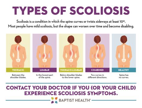 Scoliosis Types