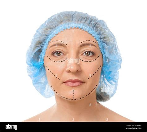 Mature Woman With Marks On Her Face Against White Background Plastic Surgery Concept Stock