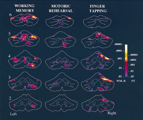 Averaged Fmri Activation In Slices 2 6 For The Working Memory Motoric Download Scientific