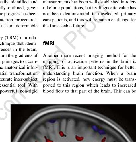 7 Example Tensor Based Morphometry Of The Ad Patients Vs Controls
