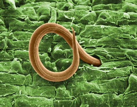 Root Knot Nematode Sem Stock Image C0093426 Science Photo Library
