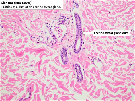 Skin Normal Histology Nus Pathweb Nus Pathweb