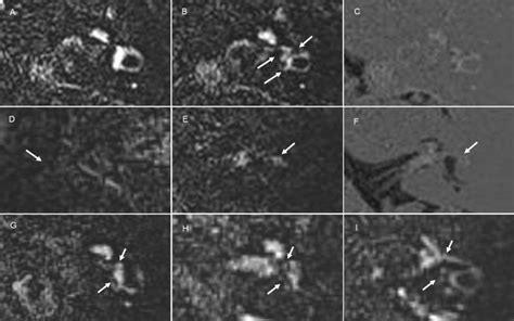 Examples Of Qualitative And Semi Quantitative Analyses Of The Endolymph Download Scientific