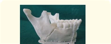 Angle Fracture In 3d Printed Model Download Scientific Diagram