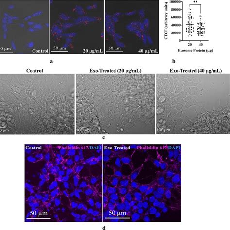 Exosome Characterization Exosomes Purified By Differential Download Scientific Diagram