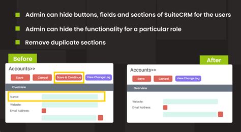 Suitecrm Global Search And Hide Manager Plugins For A Streamlined