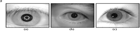 Figure 1 From Precise Pupil Boundary Detection Using Angular Integral Projection And Active