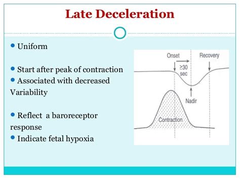 Fetal Monitoring For Undergraduate