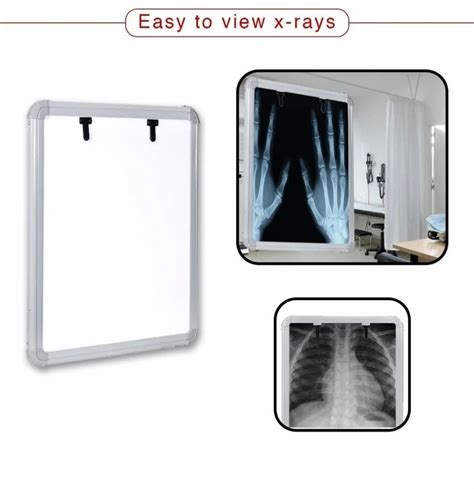 Led X Ray View Box 25 Mm At Rs 1000 In New Delhi Id 2850109807855