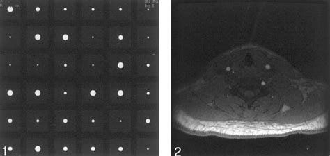Typical 2d Tof Mra Source Image Obtained In A Healthy Volunteer Image Download Scientific