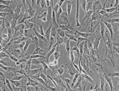 A Simple Approach To Culture Patient Specific Fibroblasts Kosheeka