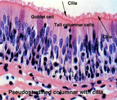 Pseudostratified Columnar Epithelium With Goblet Cells