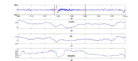 Detecting Seizure Of A Short Time From Epileptic Eeg Signals A A