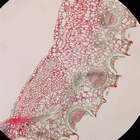 Puccinia Graminis Aeciospores Wheat Rust Phylum Basid… Flickr