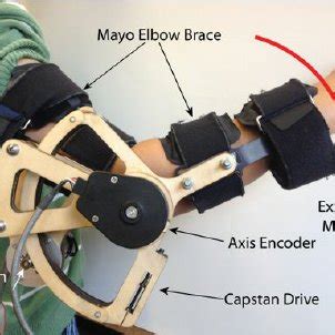 Motorized Elbow Brace With Right Handed Aircast Mayo Clinic Elbow Brace