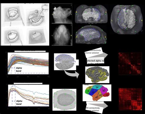 Confirmation Of Higgs Connectivity Based In Eeg That Is Recorded