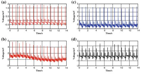 3 A The Clear Ecg Signal And The Ecg Signal With Simulated Noise C The Download Scientific