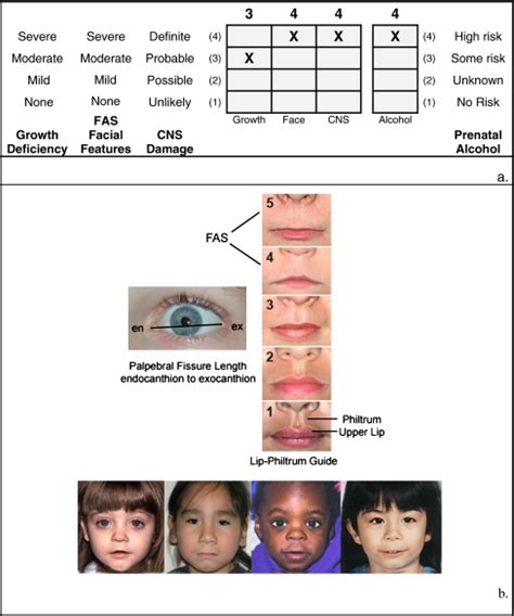 A Fasd 4 Digit Diagnostic Code Grid Fasd Is Defined By Growth
