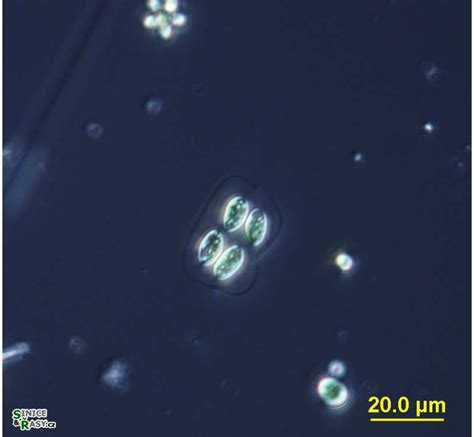 Oocystis Lacustris Galerie
