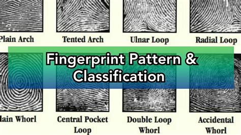 Radial Loop Fingerprint