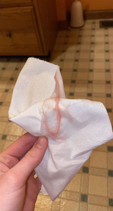 Is This Ovulation Discharge Tmi Pic Rperiods