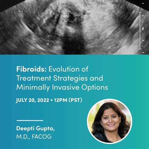 Sutter Health On Linkedin Welcome You Are Invited To Join A Webinar