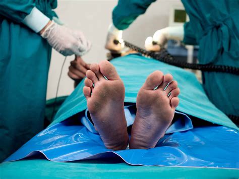 Common Are Surgical Errors Weinstein Legal Team