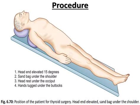 Thyroidectomy Pptx