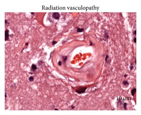 Formalin Fixed Paraffin Embedded Tissue Sections Stained With Download Scientific Diagram